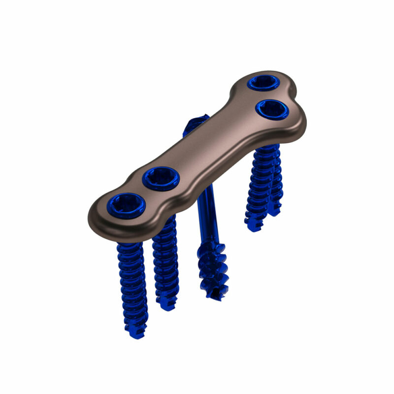 F.A.S.T® Plates • Steps Ortho